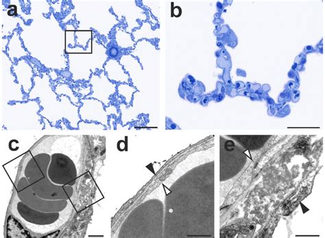 Alveolar Capillaries In Classical Light And Electron Microscopy A