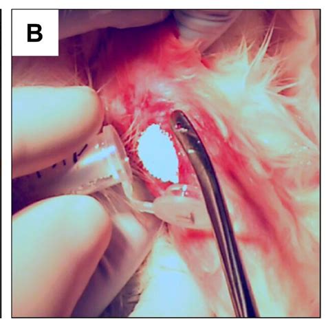 Lateral Radiographs Of A Defect In The Proximal Tibial Metaphysis