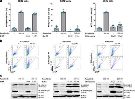 Autophagy Inhibitors 3 Methyladenine Bafilomycin A1 And Chloroquine