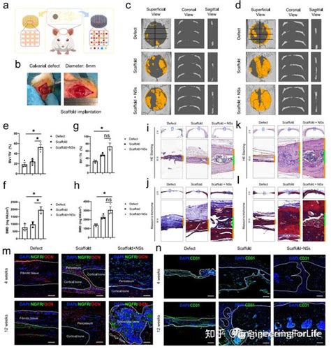 《nc》：水凝胶助攻临界大小的骨缺损全层再生 知乎
