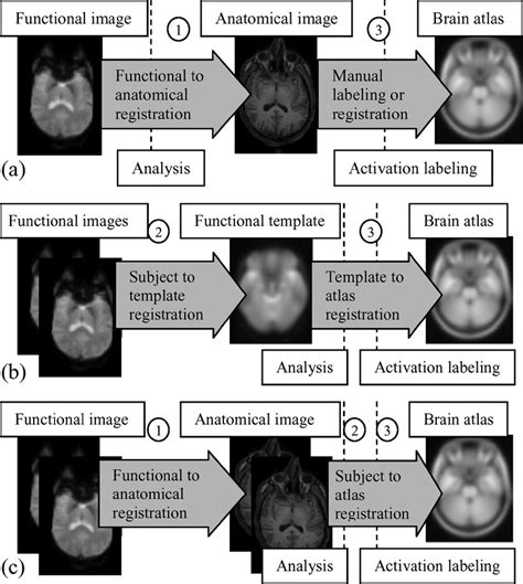 various functional localization procedures a single subject analysis download scientific