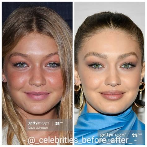 Celebrities Before After On Instagram Gigi Hadid Before And After