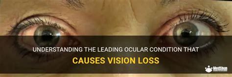 Understanding The Leading Ocular Condition That Causes Vision Loss
