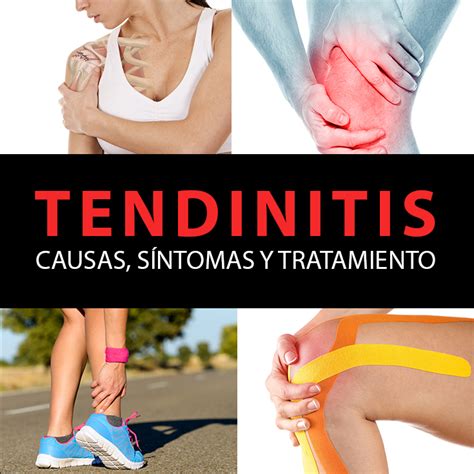 Tendinitis Causas Síntomas Y Tratamiento La Guía De Las Vitaminas