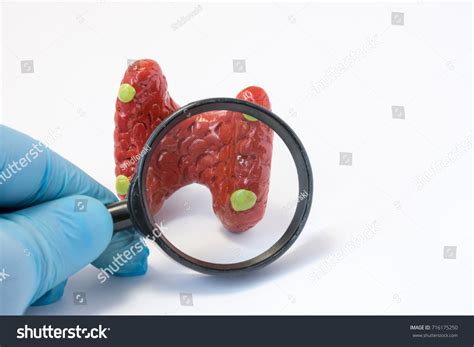 Parathyroid Gland Disorder Photos Images And Pictures Shutterstock