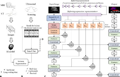 Figure From Deep Learning Based Real Time Segmentation In Ultrasonic