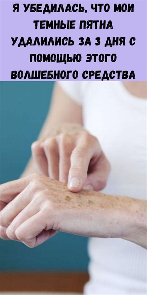 Красота и уход Темные пятна Советы красоты Пятна