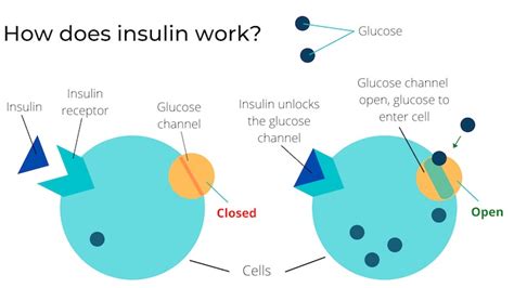 What Is Insulin Resistance