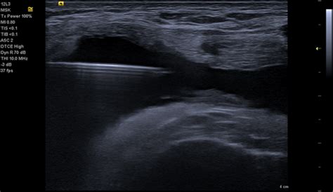 Msk Ultrasound