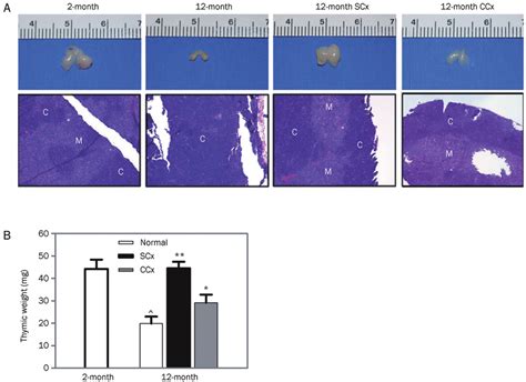 Surgical And Chemical Castration Enhanced Thymic Mass And Restored