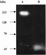 Electrophoretic Analysis Of Purified α Galactosidase From Rhodothermus