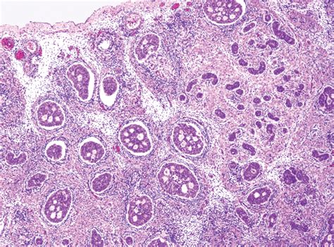 Testis Epididymis Histology