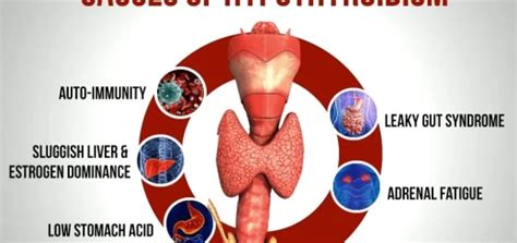 Pneumonia Causes Types Treatment Is Pneumonia Usually Serious And