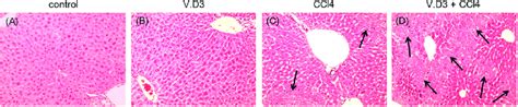 Pretreatment With Vd3 Becomes Worse Animals From Acute Ccl 4 Induced