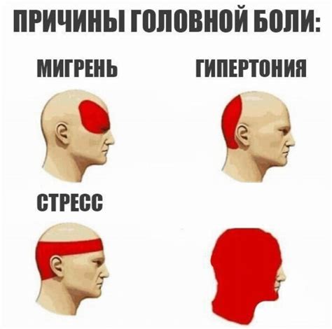 Create Meme Causes Of Headache Types Of Headaches Pictures Meme