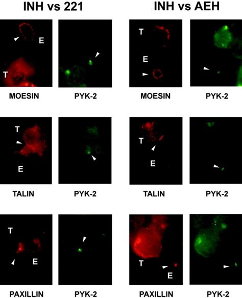 Subcellular Localization Of Different Cytoskeletal Proteins In