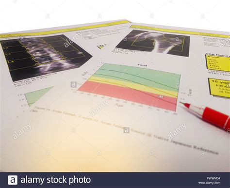 Bone Density Scan Stock Photos Bone Density Scan Stock Images Alamy