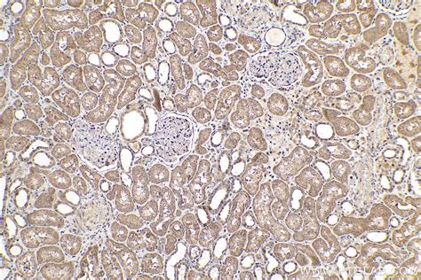 Ihceasy Lox Ready To Use Ihc Kit Khc0630 Proteintech