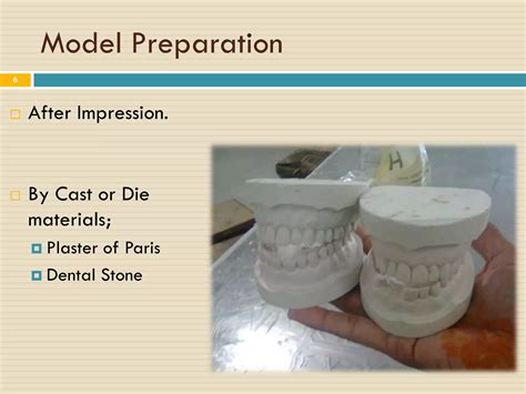 Removeable Partial Denture Steps Pptx