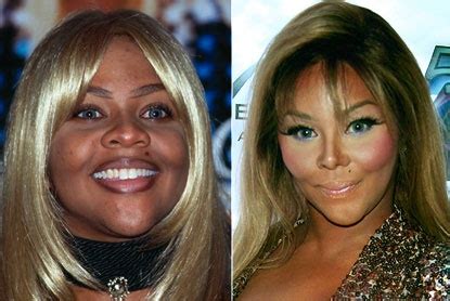 Wow Lil Kim Before And After All Her Plastic Surgery Mess She Looks