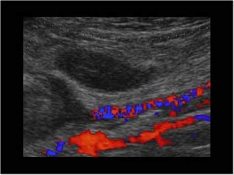 Peripheral Vessels 101 Peripheral Arteries Case 1016 True