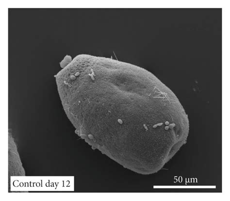 Images At Scanning Electron Microscope Of E Granulosus Ss Download Scientific Diagram
