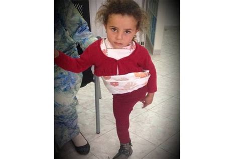 Lanzan una campaña de crowdfunding para pagar una prótesis a una niña