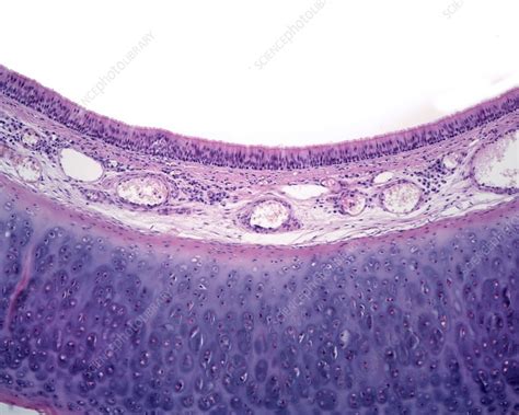 Trachea Light Micrograph Stock Image C0385552 Science Photo Library