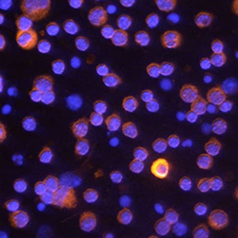 Mouse Caspase 11caspase 4 Antibody 100μg Unlabeledantibodies