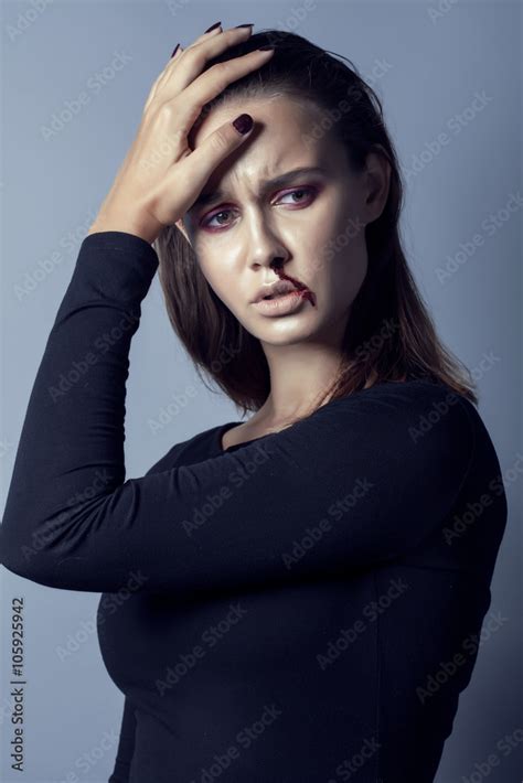Problem Depressioned Teenager With Bleeding Nose Real Junky Close Up