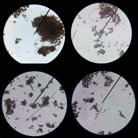 Microscopy Could Someone Identify These Microorganisms On Microscope