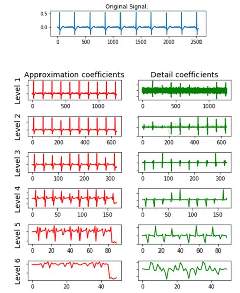 dwt applied on ecg signal download scientific diagram