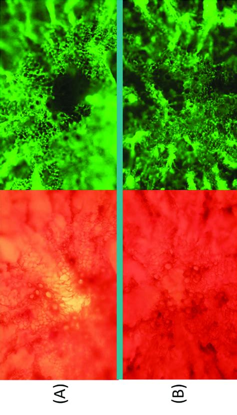 100x Microscope Image Of The Xylem After ~16 H Of Incubation A Carrot
