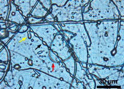 Optical Microscope Image Of Rbcs Encapsulated In Electrospun Pcl