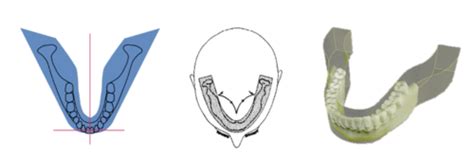 Panoramic Radiograph Flashcards Quizlet