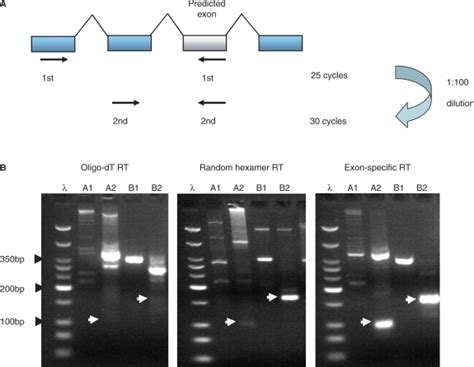 Semi Nested Pcr Is More Sensitive At Detecting Exons Using