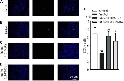 BM MSCs Countervailed High Fat Fed Induced Damage To Proliferation