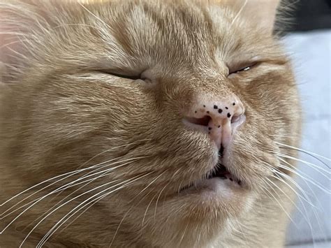 Lewis Has Lentigo Simplexits Just Freckles Rorangecats