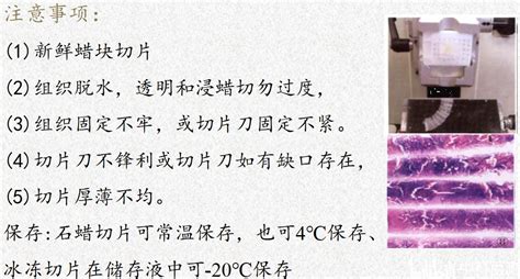 常规病理组织切片染色原理及简单病理分析百测网 哔哩哔哩