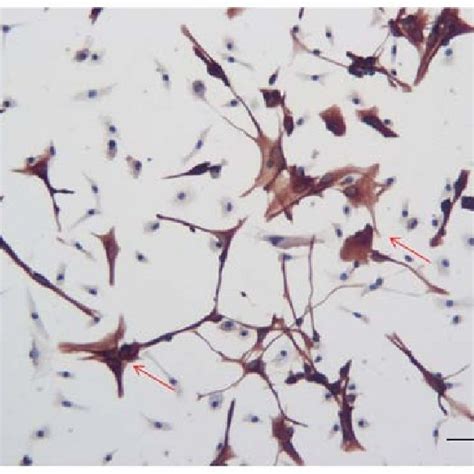 Primary Cultured Glial Cells Express Glial Fibrillary Acidic Protein