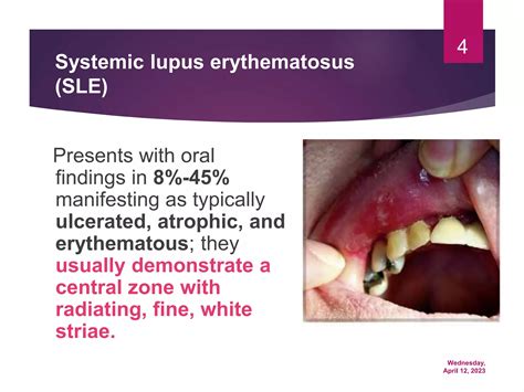 Oral Manifestation Of Systemic Diseases Ppt
