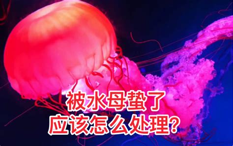 被水母蛰了应该怎么处理 哔哩哔哩