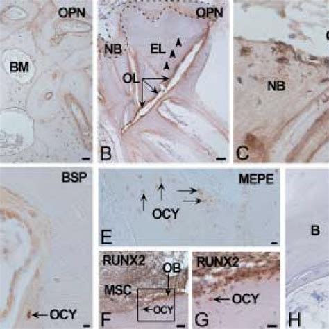 Immunolocalization Of Sibling Proteins In Undistracted Bone Baseline