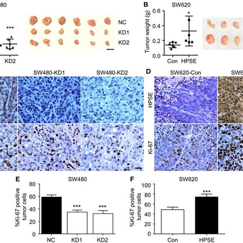 Hpse Promotes The Proliferation Of Crc Cells In Vivo Cells Were