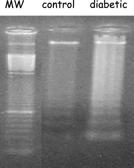 Effect Of Alloxan Induced Diabetes On Internucleosomal Dna