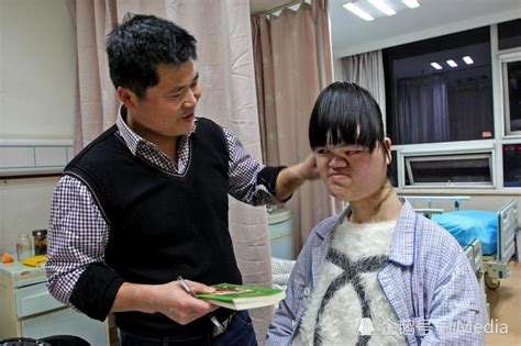 17岁少女患世界罕见怪病 父母辗转15家医院求医却遭拒绝