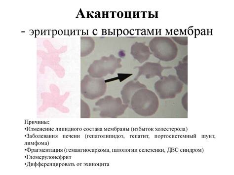 Патологические формы эритроцитов презентация онлайн