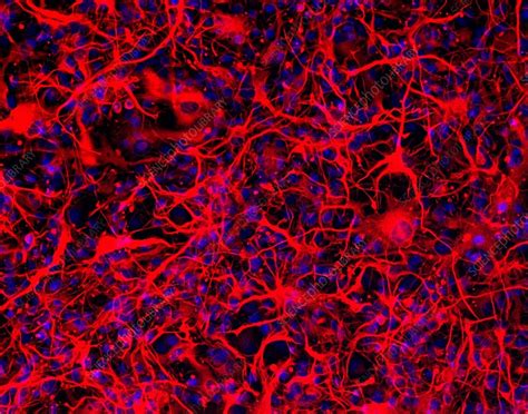 Astrocyte Cells Fluorescence Light Micrograph Stock Image C051 0703 Science Photo Library