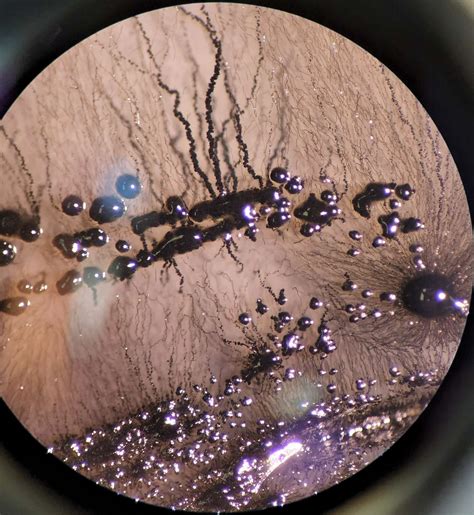 Aureobasidium Pullulans De Bary And Löwenthal Garnaud