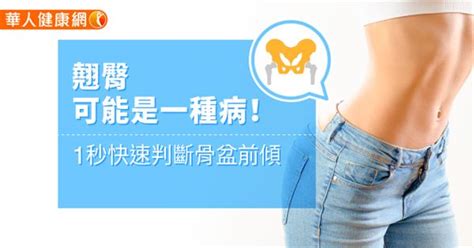 翹臀可能是一種病！1秒快速判斷骨盆前傾 蕃新聞